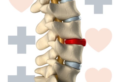 Prolaps: Symptomer, årsaker, behandling og forebygging